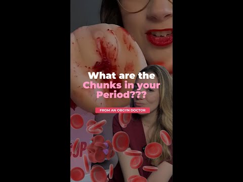 What are the chunks in my period?