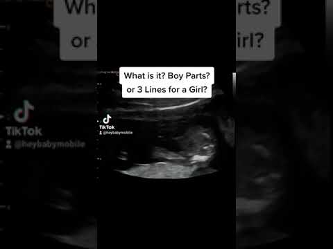 Gender Reveal Ultrasound at 15 Weeks Pregnant!