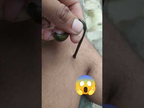 Leech drank blood from my feet #leech #joke