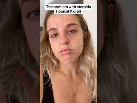 The problem with steroids (topical & oral)