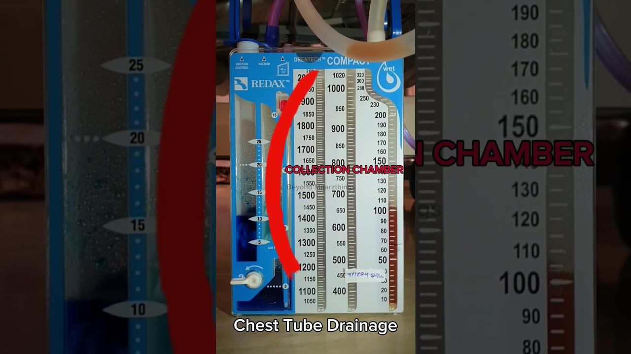 Chest Tube Drainage || REDAX (Drentech COMPACT) #chesttube #drainage #shorts