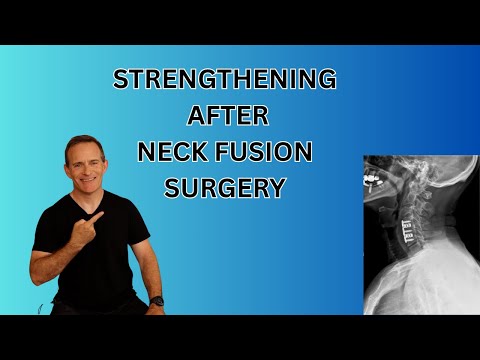 STRENGTHENING EXERCISES AFTER ANTERIOR CERVICAL FUSION, ACDF.