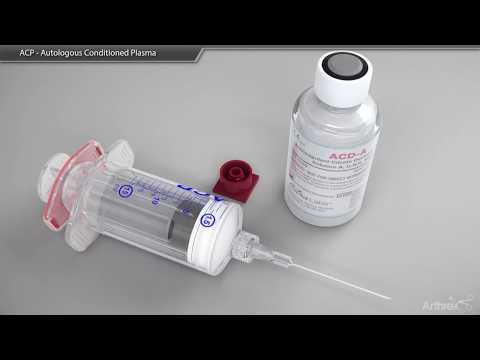 ACP - Autologous Conditioned Plasma