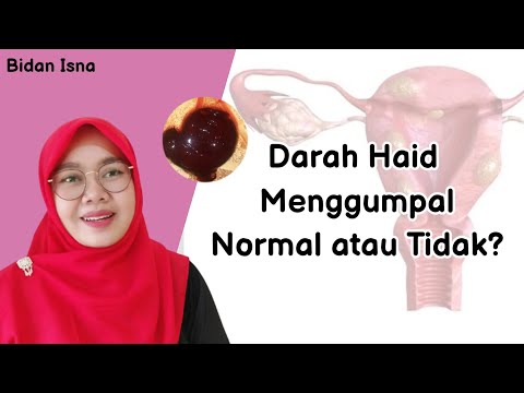 DARAH HAID MENGGUMPAL NORMAL ATAU TIDAK, KAPAN HARUS KE DOKTER, BIDAN ISNA