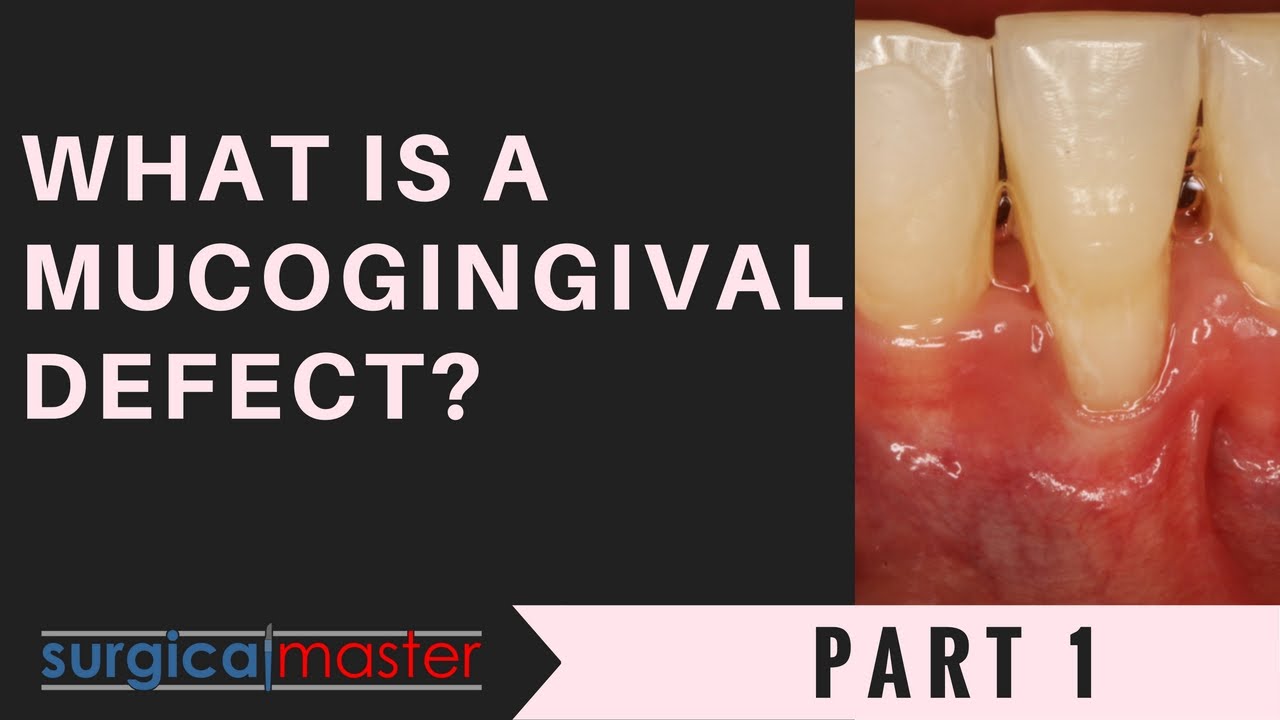 What is a MUCOGINGIVAL defect? PART 1