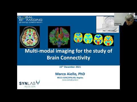 Multi modal imaging for the study of brain connectivity