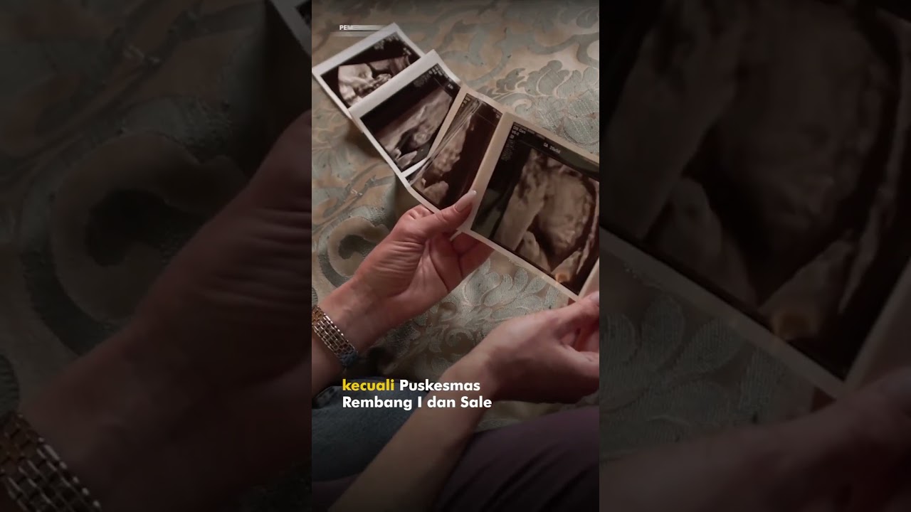 Sekarang Ibu Hamil Bisa USG Gratis di 15 Puskesmas di Rembang