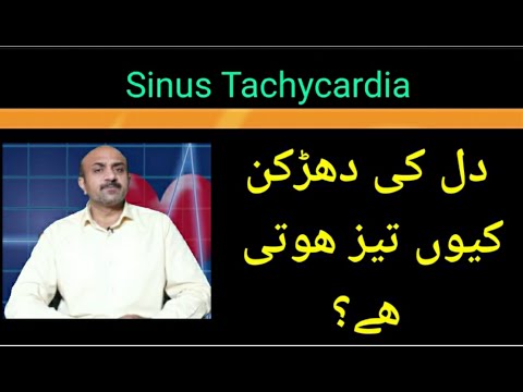 What is Sinus Tachycardia?