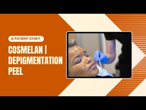 A Patient Story | Cosmelan | Depigmentation Peel | West Hollywood, CA | Dr. Jason Emer