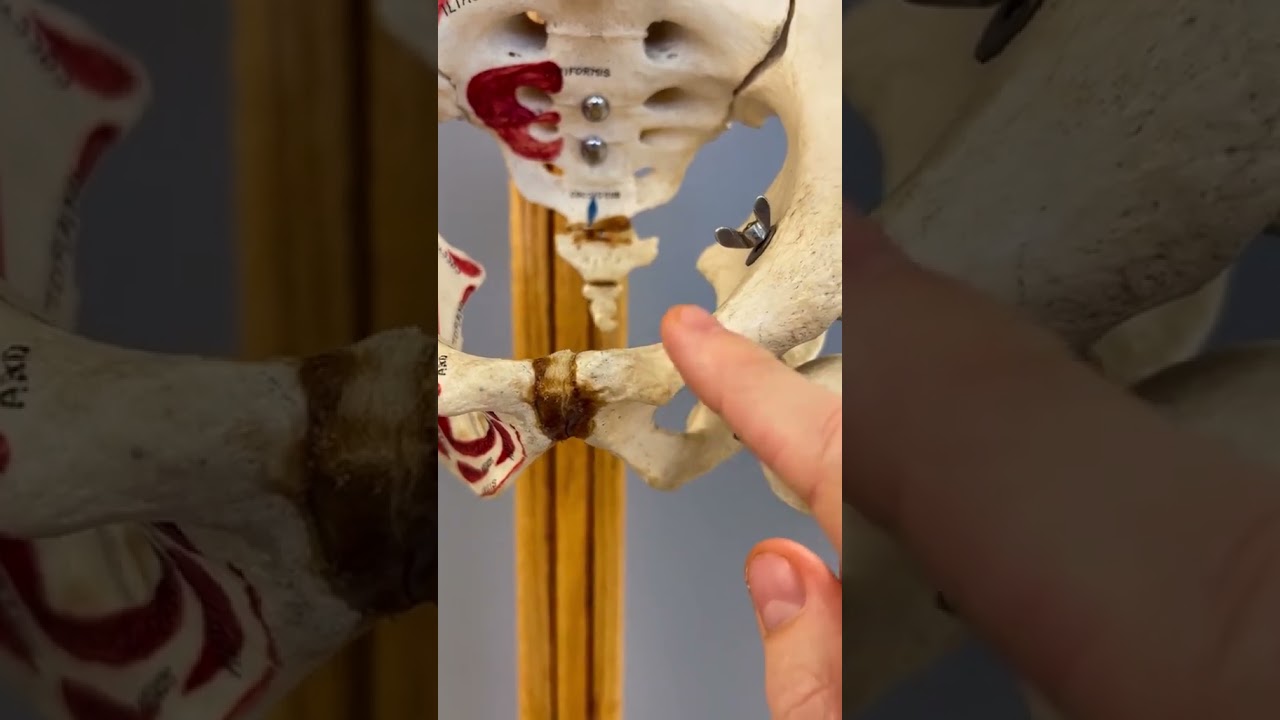 ¿tubérculo PÚBICO?