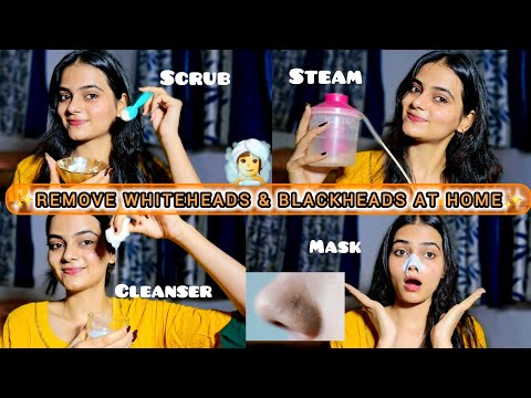 Remove Blackheads & Whiteheads at Home💯|Blackheads &Whiteheads💦 #openpores #kritikatripathi #beauty