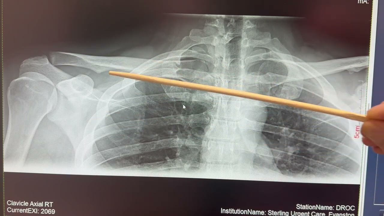 Clavicle Series Film Critique