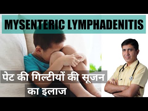 Mesenteric Lymphadenitis/ Lymphadenopathy Treatment In Hindi | बार- बार होने वाले पेटदर्द का इलाज