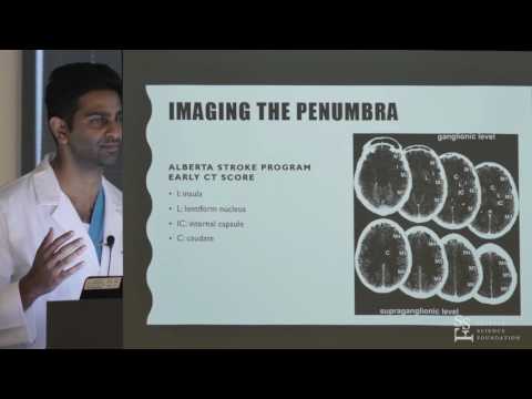 Zero to one: The golden age of stroke care - Akshal S. Patel, M.D.