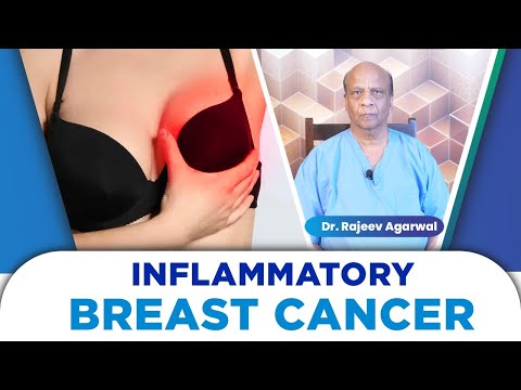 🎗️Inflammatory Breast Cancer क्या होता है?✳️Symptoms, Diagnosis and Treatment(हिंदी)| ब्रैस्ट कैंसर