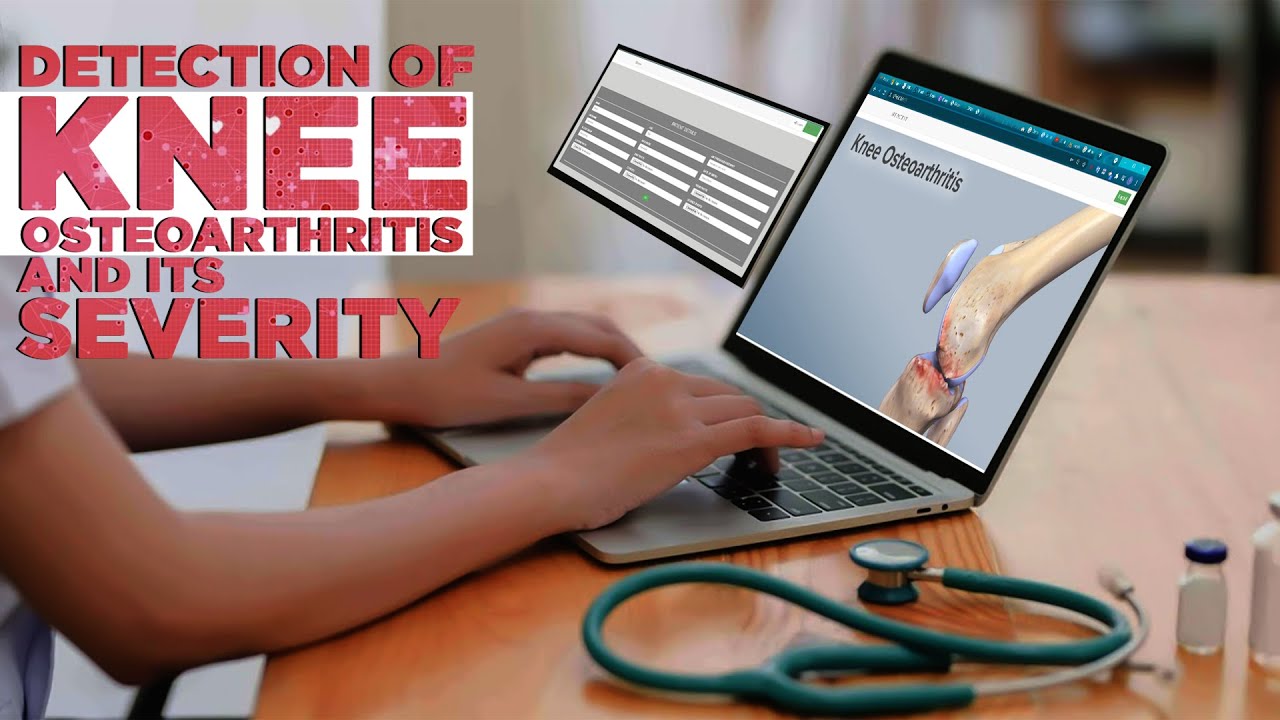 Online Knee Osteoarthritis Using Image Processing | Python Project