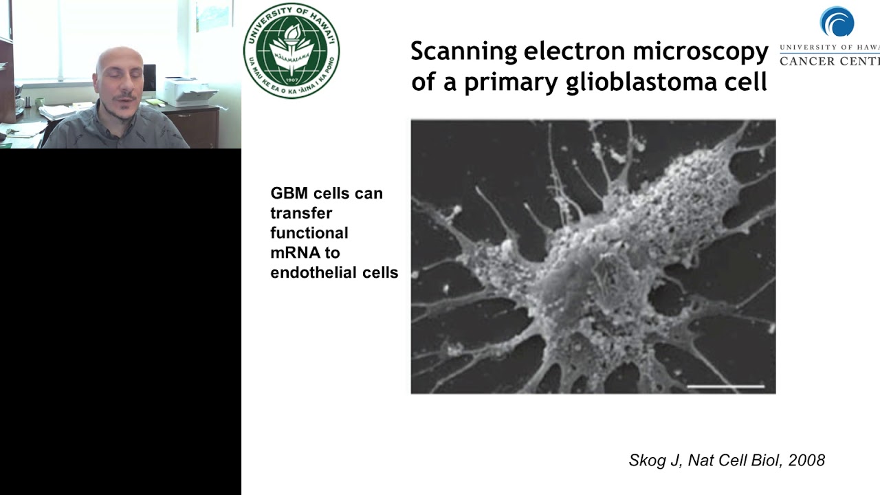 MicroRNAs in Extracellular Vesicles orchestrate the biology of the Tumor Microenvironment