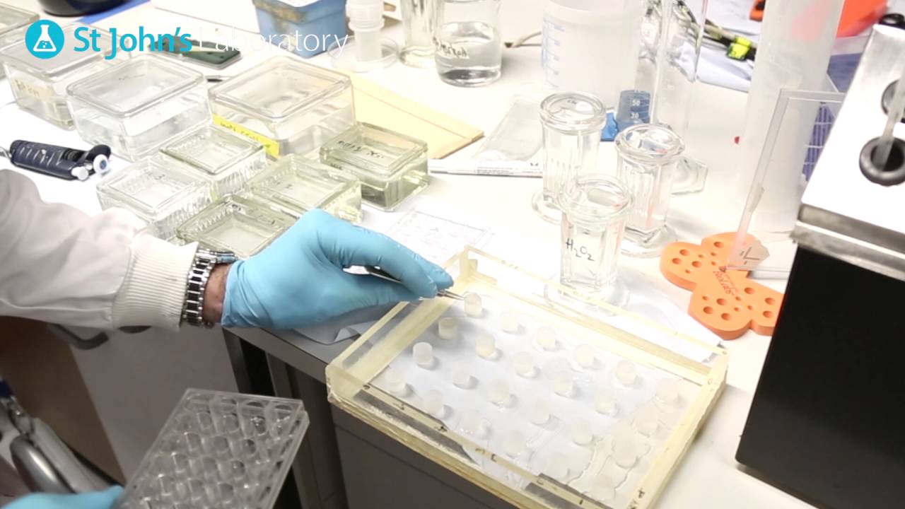 Immunocytochemistry (ICC) - Video Protocol Series