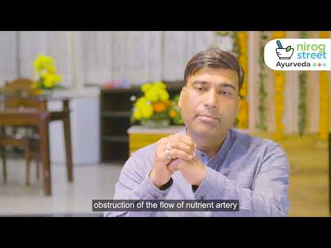 Avascular necrosis (AVN) meaning and Ayurvedic Treatment in Hindi