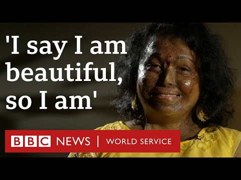 'I say I am beautiful, so I am' - 100 Women, BBC World Service