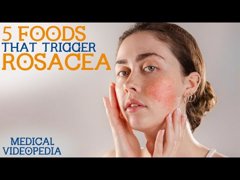 Most Common Foods that Cause Rosacea