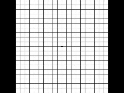 Macular Degeneration Vision Test Using Amsler Grid