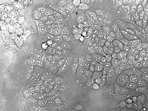 Combretastatin CA-4 and combretastatin derivative induce mitotic catastrophe dependent on spindle c