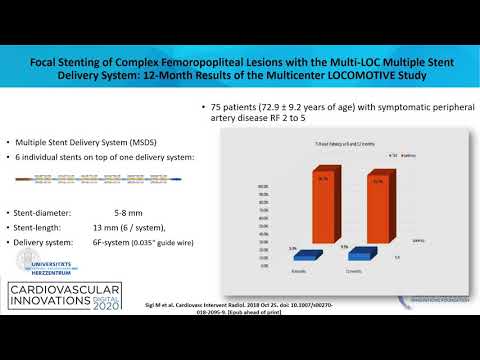 DCB, DEs, wire interwoven, or covered stents, segmentalize approach to - Thomas Zeller, MD, PhD