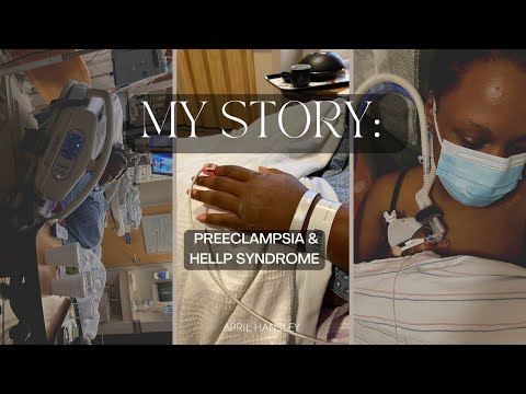 MY STORY: PREECLAMPSIA, HELLP SYNDROME, PREMATURE BIRTH