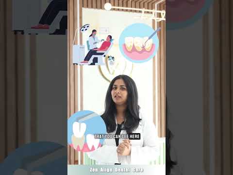 secret ways celebrities get perfect teeth and smile | zen align dental care