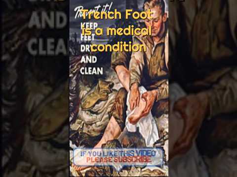 Trench Foot: The Horror of WW1 #shorts #history #facts