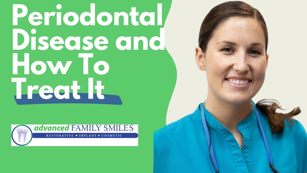 Periodontal Disease and How To Treat It | Advanced Family Smiles