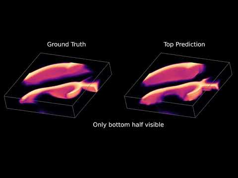 Videos | Cardiac Vision Laboratory