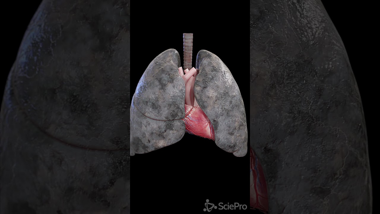 Stop smoking! Anatomy of a smoker´s lung.  #anatomy #meded #3danimation