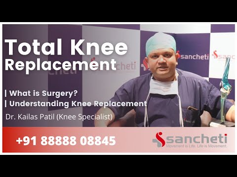 Total Knee Replacement | What is TKR Surgery? | Understanding Knee Replacement | Myths About Surgery
