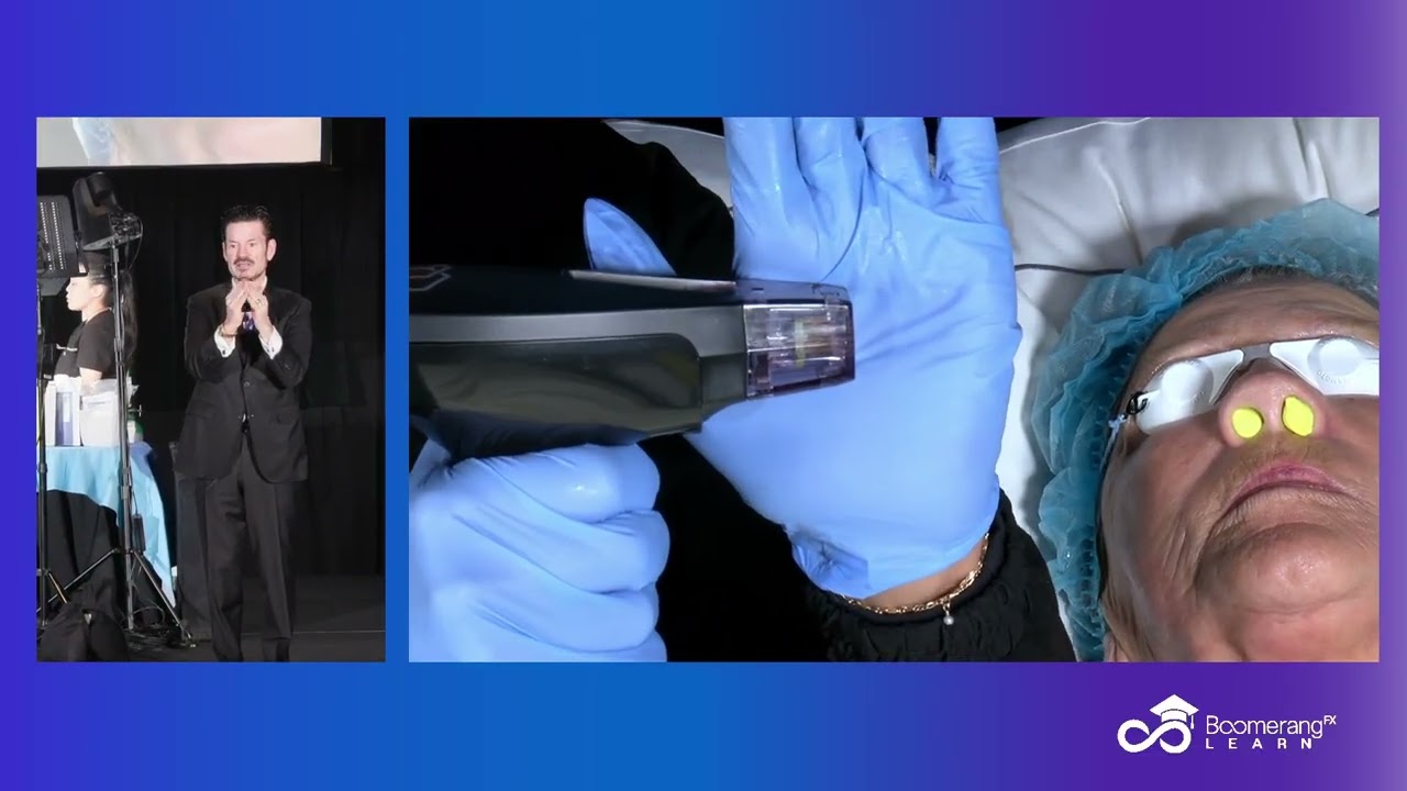 Morpheus8 - One treatment every 23 seconds