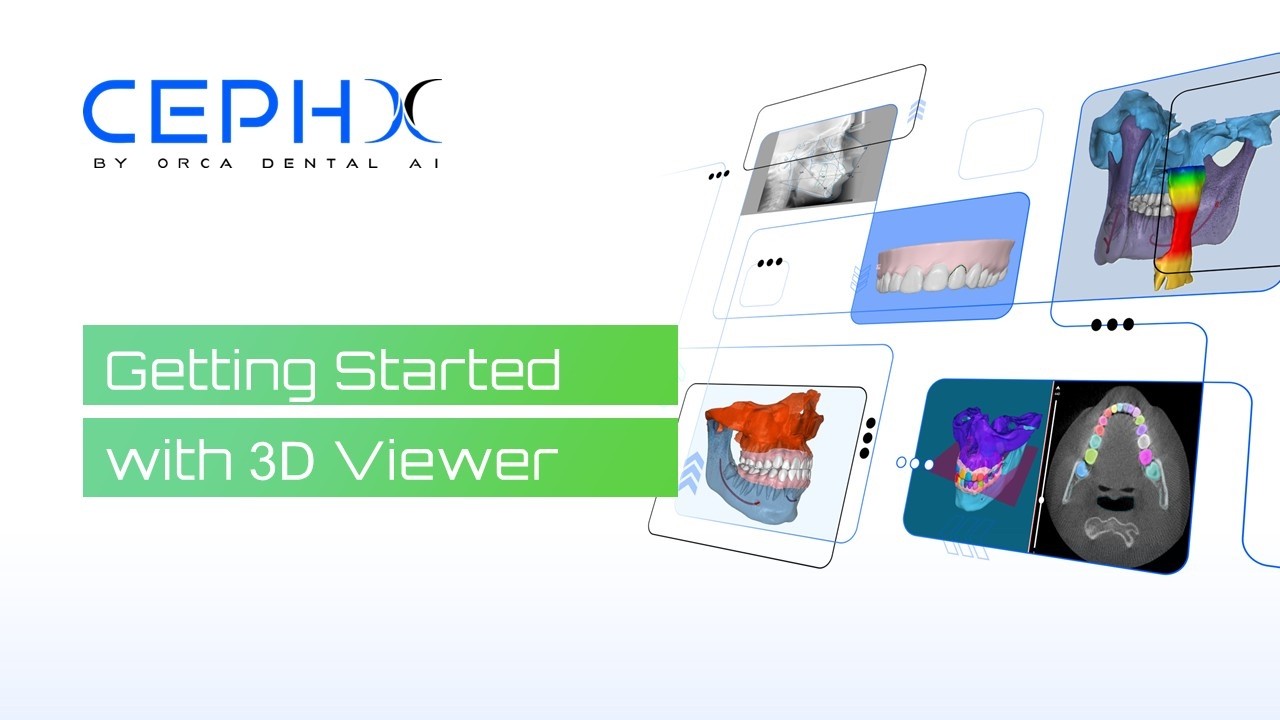 Getting Started with CephX 3D Viewer