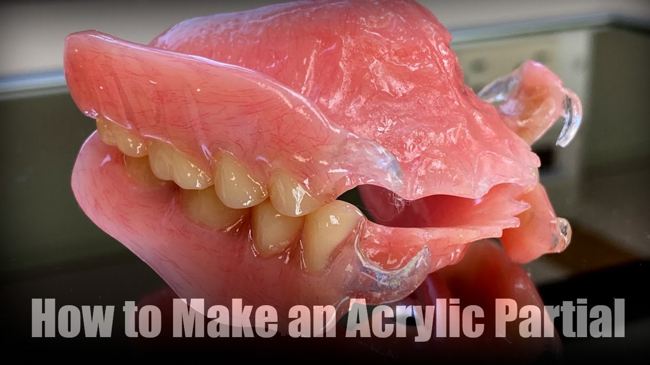 How to Make an Acrylic Partial | Step-By-Step