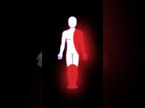 Understand Causalgia