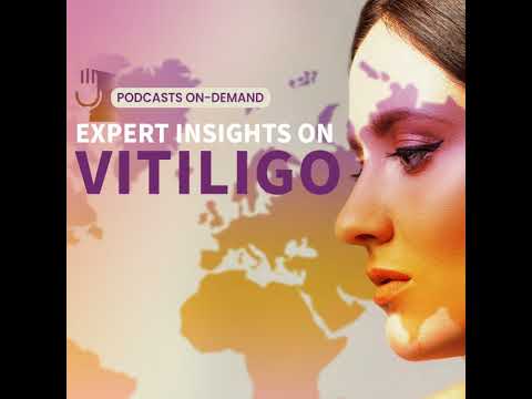 Expert Insights on Vitiligo: How Do Emerging Treatment Options Have the Potential to Transform Pa...