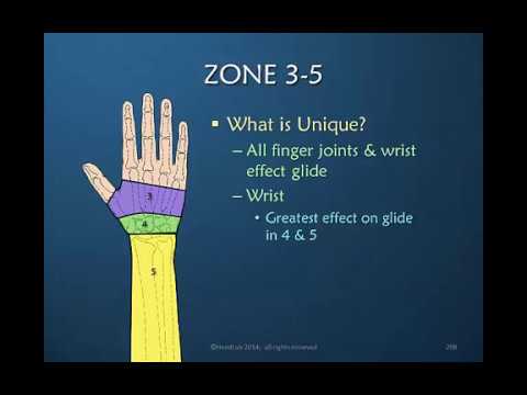 Nuances of Flexor Tendon Rehab: Part 12 of 12: Zones 3-5 & Review