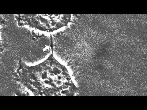 The midbody during cell division: UMass Medical School Doxsey Lab