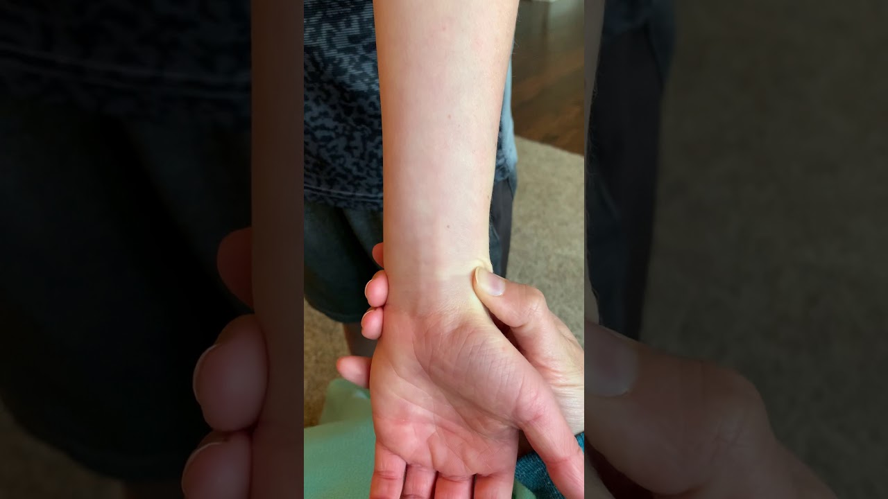Palpation: Styloid Process of Radius