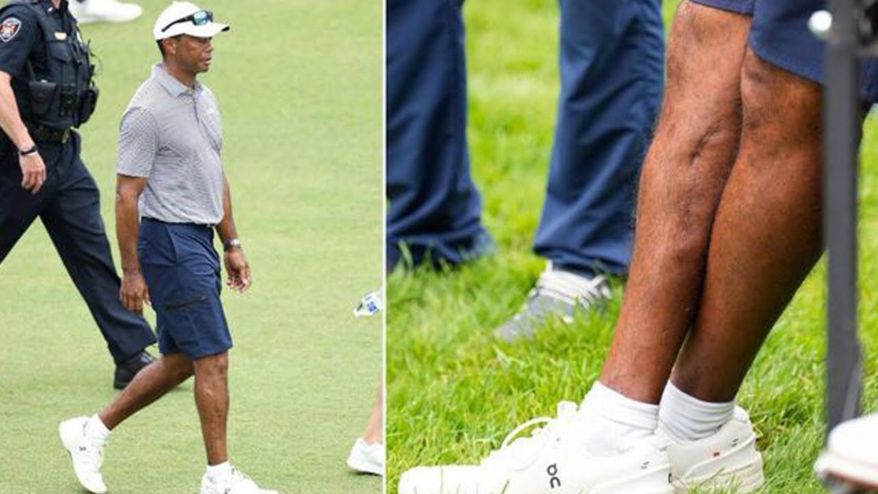 Tiger Woods' horror car crash injuries on show for first time after near-death ordeal