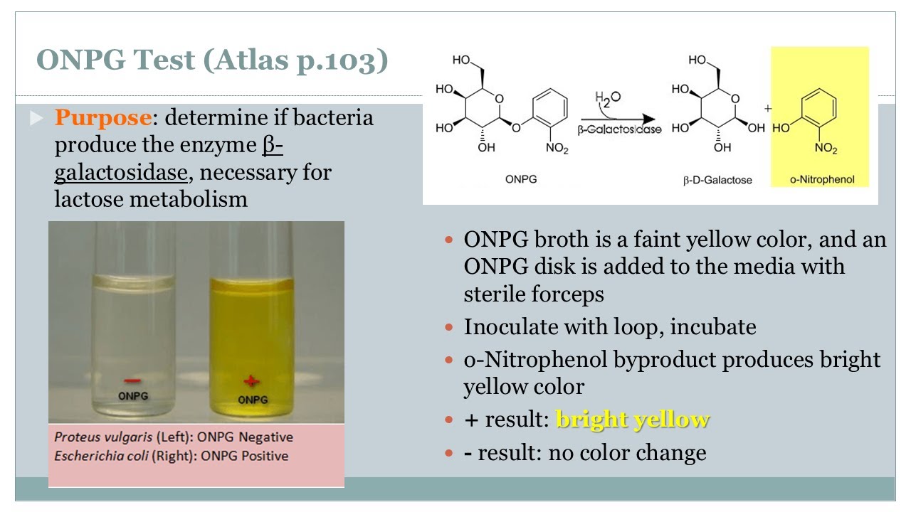ONPG Test - Microbiology Class - Podcast (CC)
