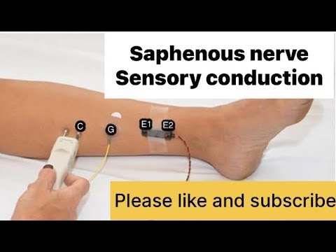 SAPHENOUS NERVE sensory nerve #NCS #neurology #neurotech