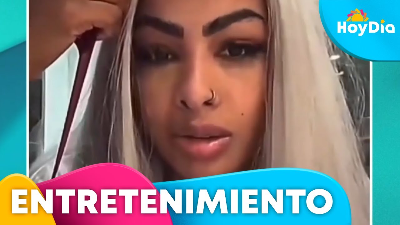 Yailin La Más Viral publica foto y se ve con heridas en la cara | Telemundo Entretenimiento