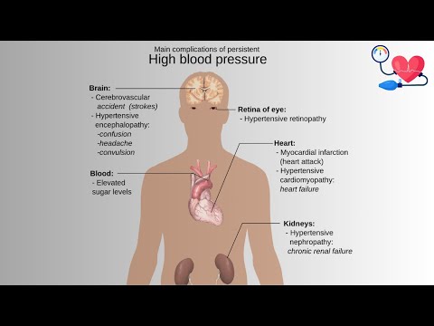 High Blood Pressure Facts You Should Know | Dr Geoffrey | Emergency Medicine Physician