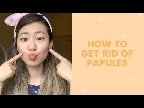 How to Get Rid of Papules | FaceTory