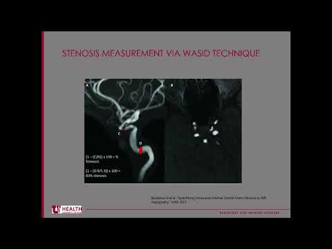 Scientific Session I 1 MRA Techniques and Their Role in Stroke Imaging – Presented by Hediyeh Barada